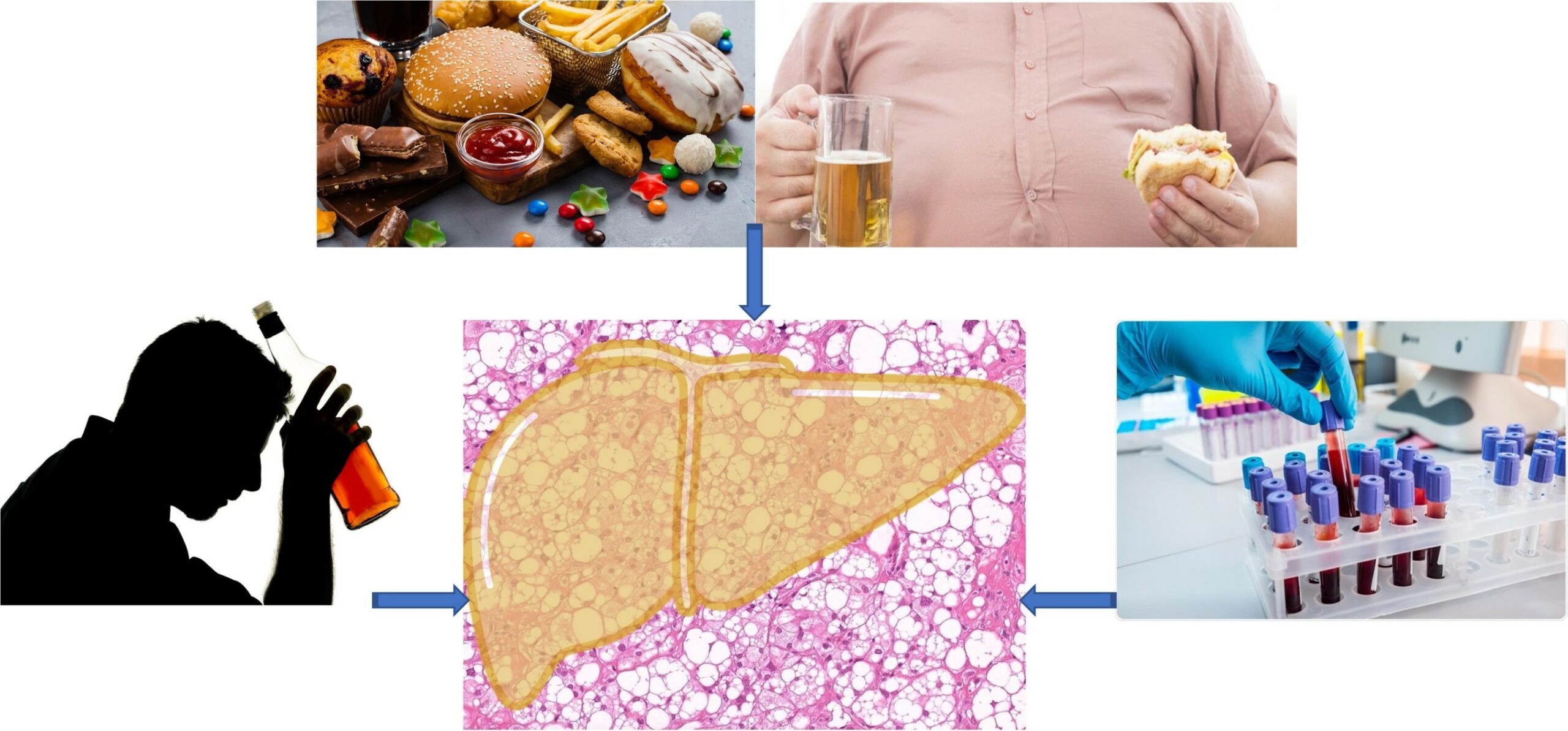 ASH, NASH & MASH - ROASTED AMYGDALA